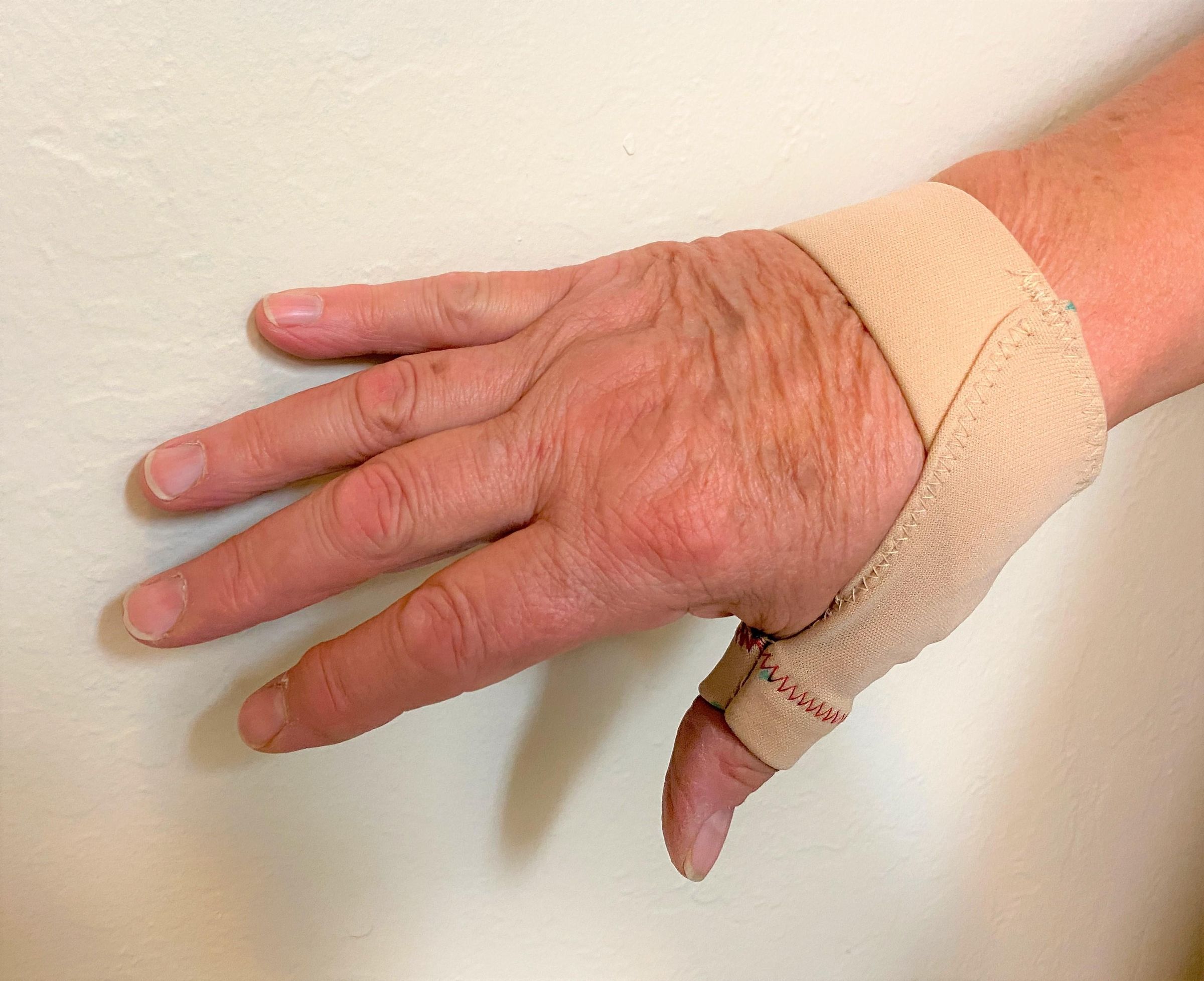 Make a Splint for Your Sore Thumb Joint : 10 Steps (with Pictures ...