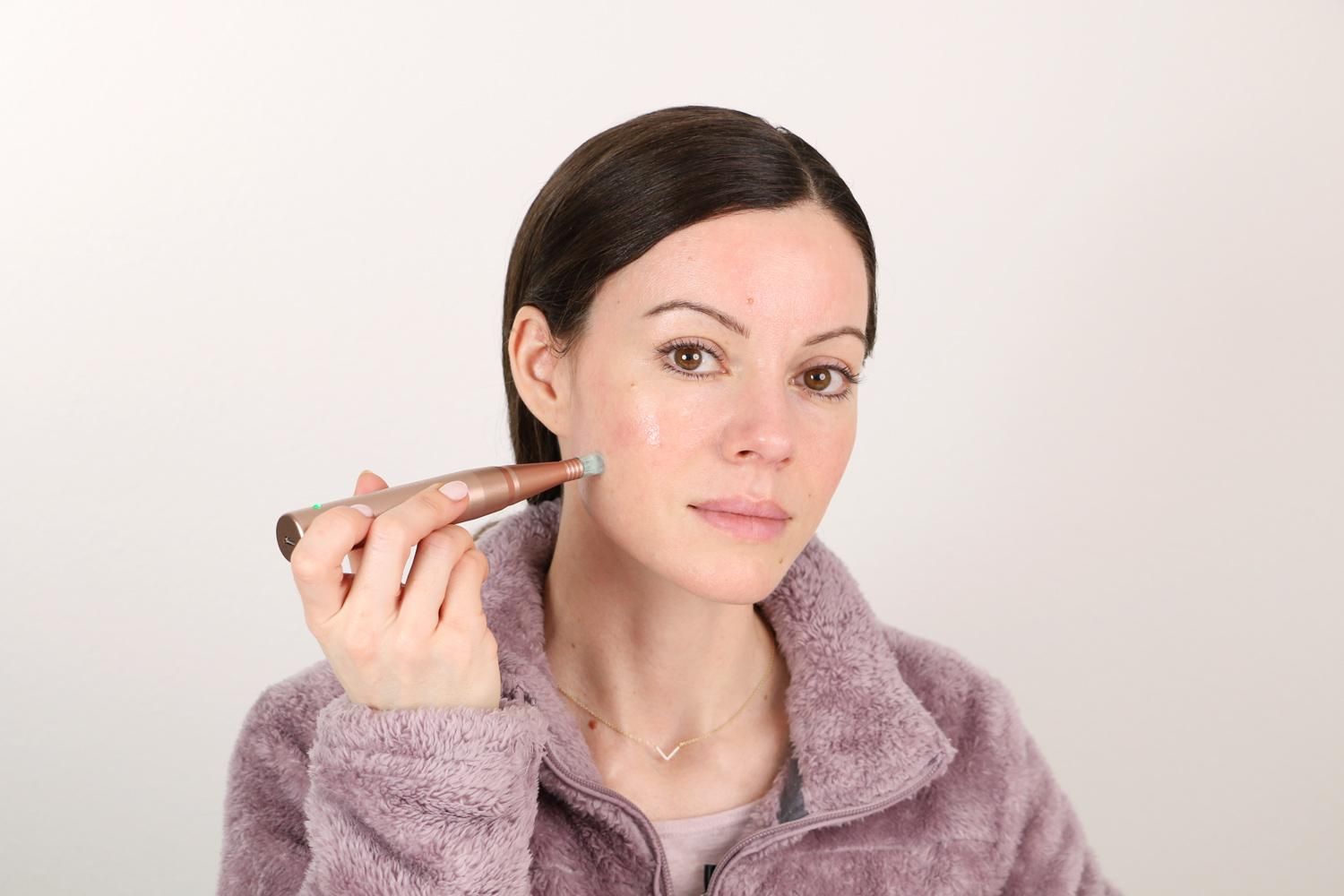 Nano Needling at Home - How to & My Results : 3 Steps (with Pictures ...