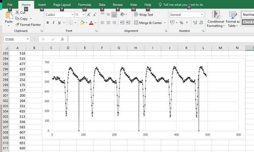 DIY ECG EKG Portable Heart Monitor : 8 Steps (with Pictures ...