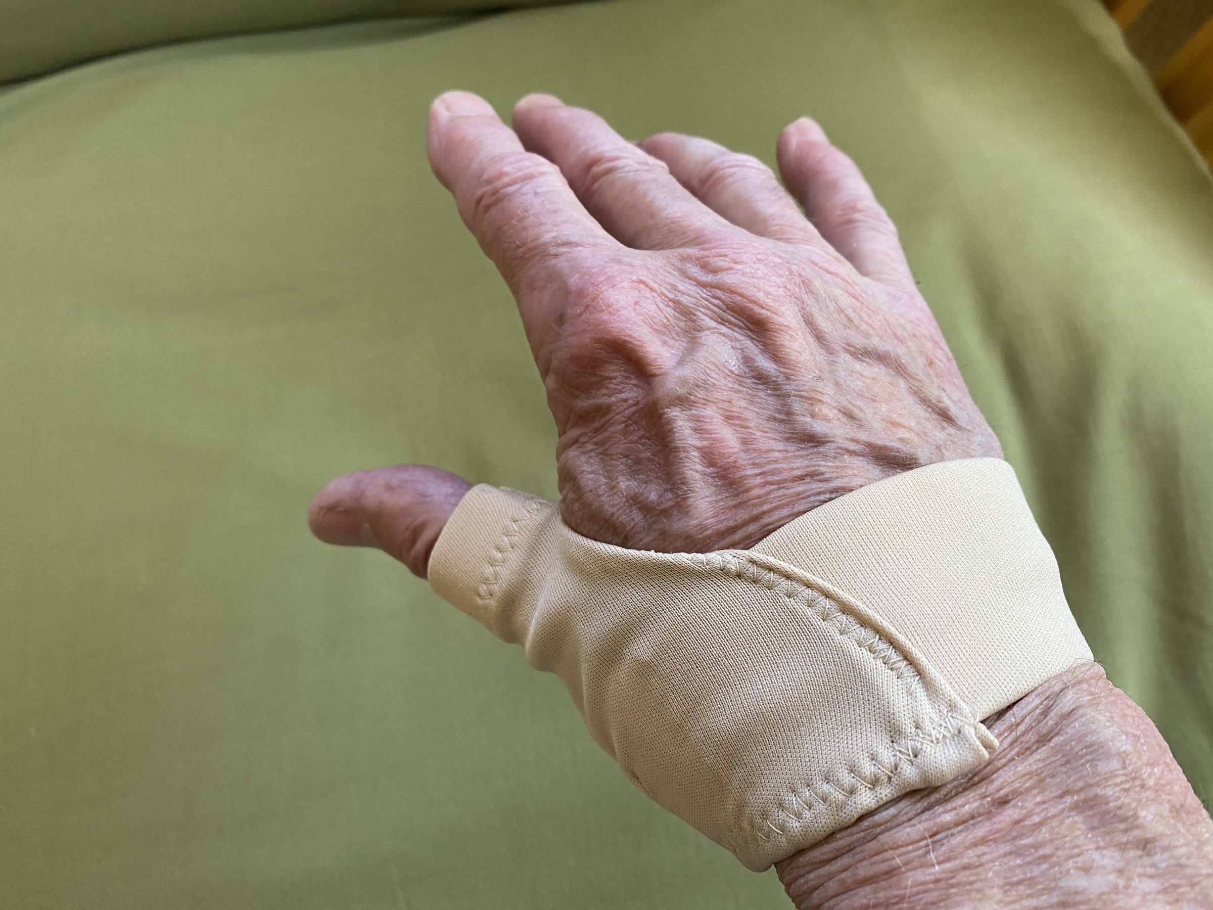 Make a Splint for Your Sore Thumb Joint : 10 Steps (with Pictures ...