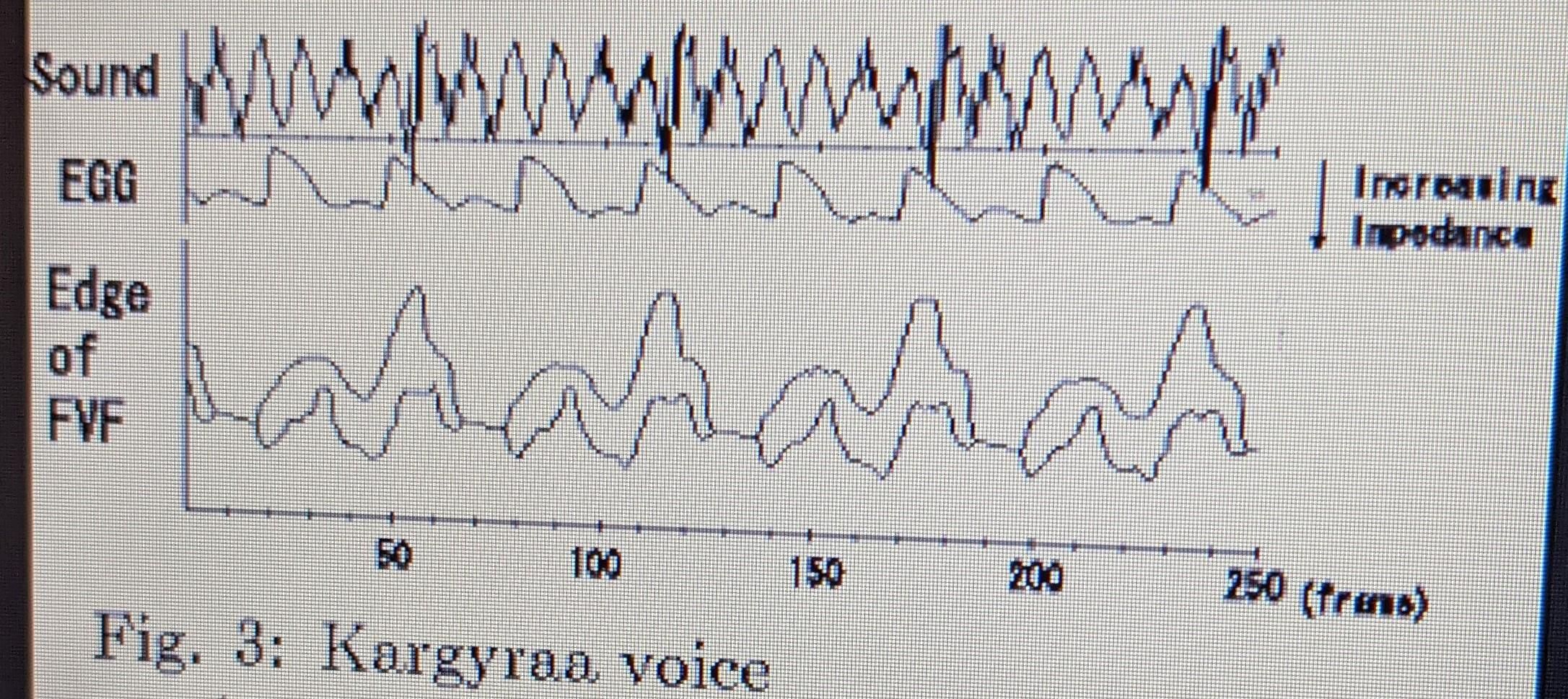 How to Play the Kazoo : 5 Steps - Instructables