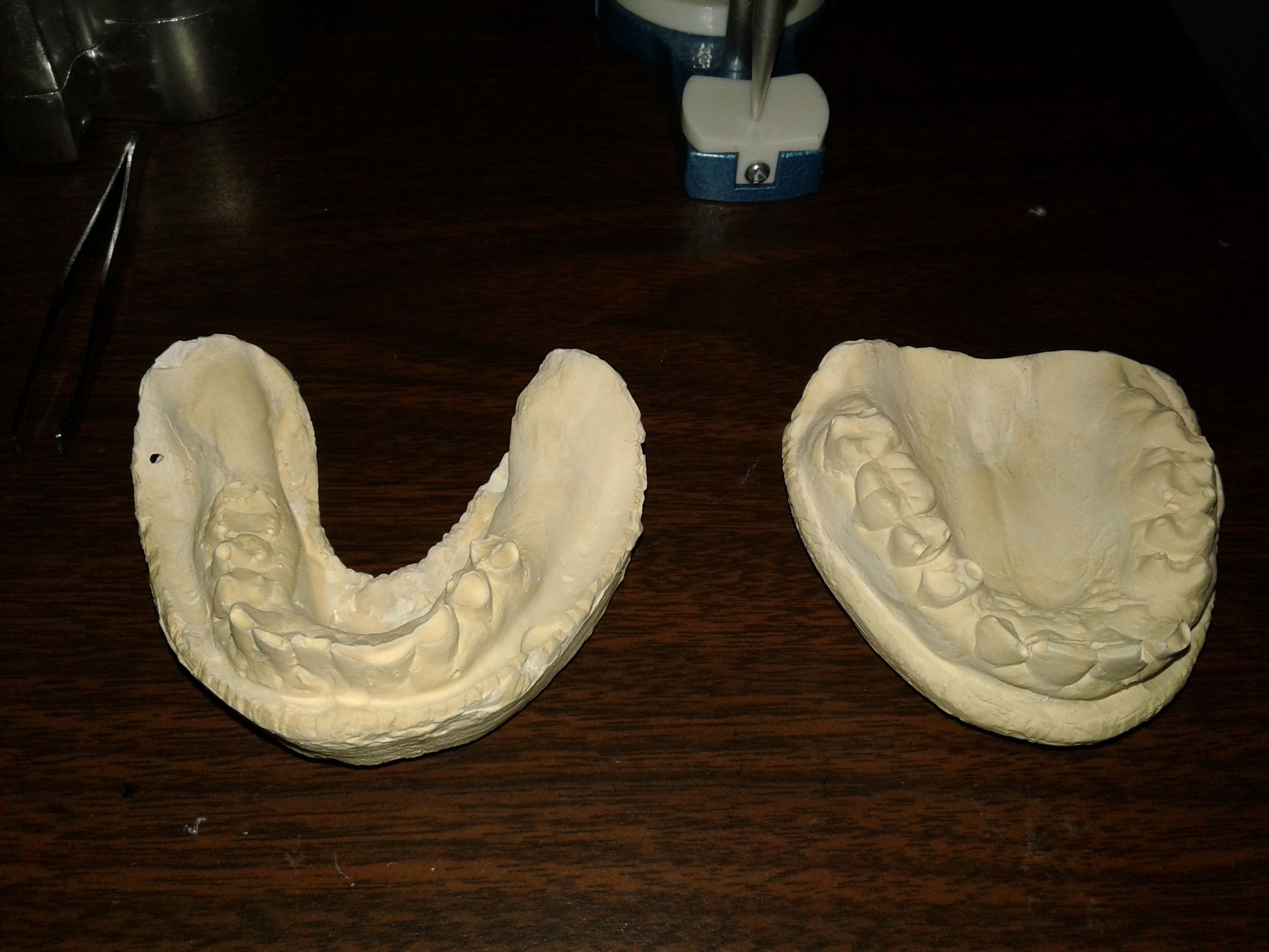 DIY Dentures : a Post-Surgical Plan : 12 Steps (with Pictures ...