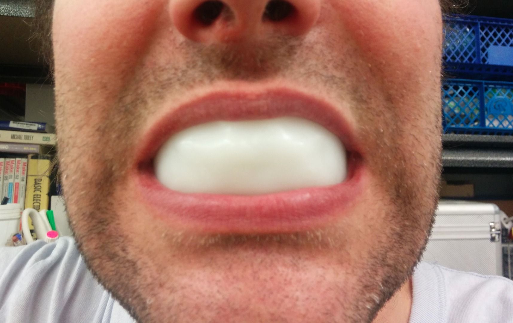 Instamorph Gum Sheild (mouth Guard) : 3 Steps (with Pictures ...