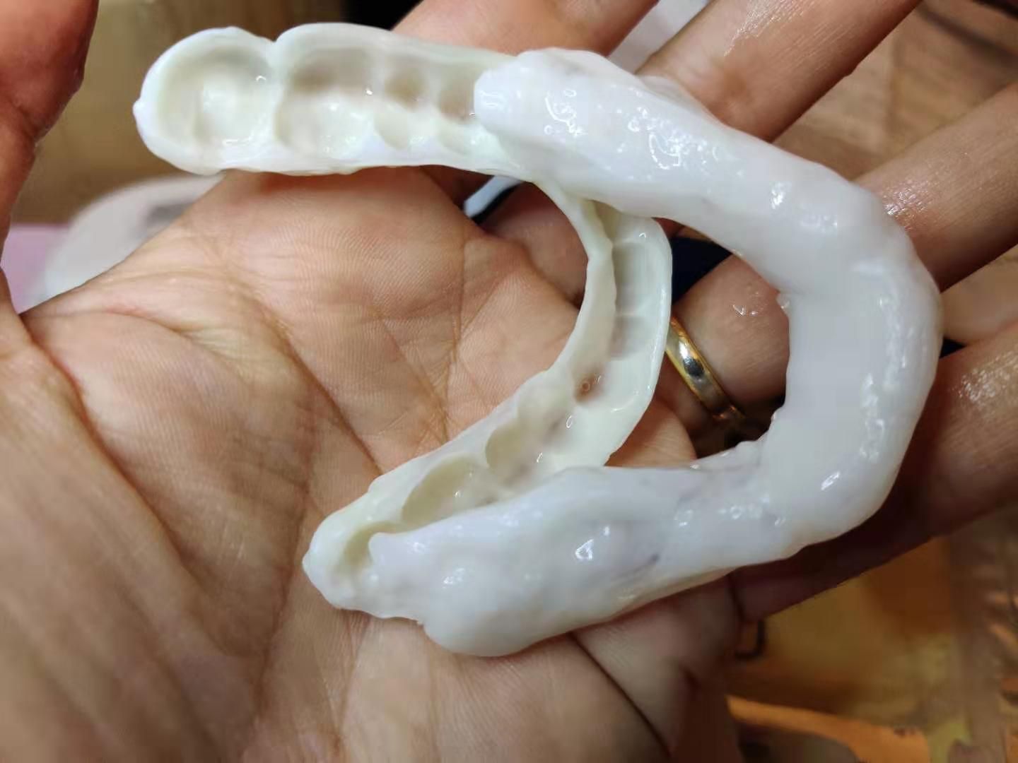 Make a Night Time Orthodontic Retainer : 3 Steps - Instructables